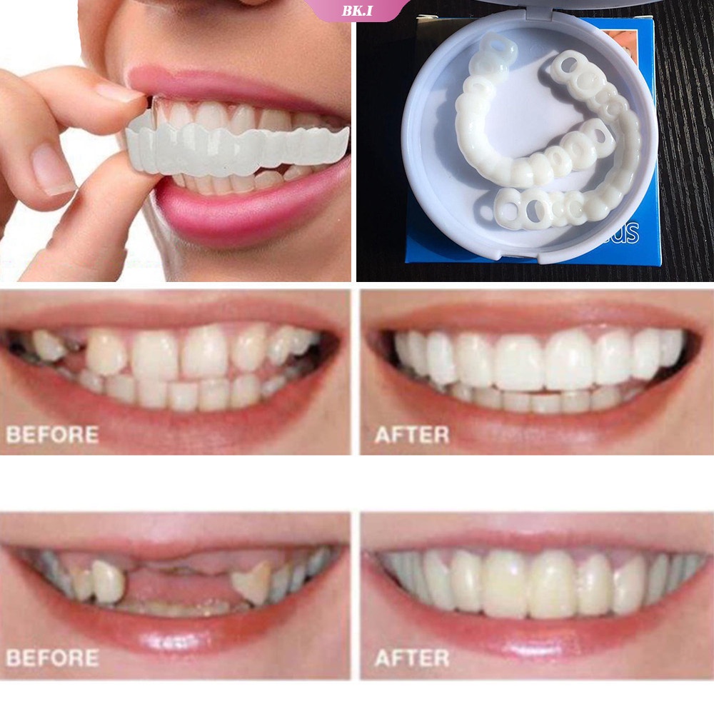 Kit de dientes falsos superior / inferior, dientes de chapa de risa ...