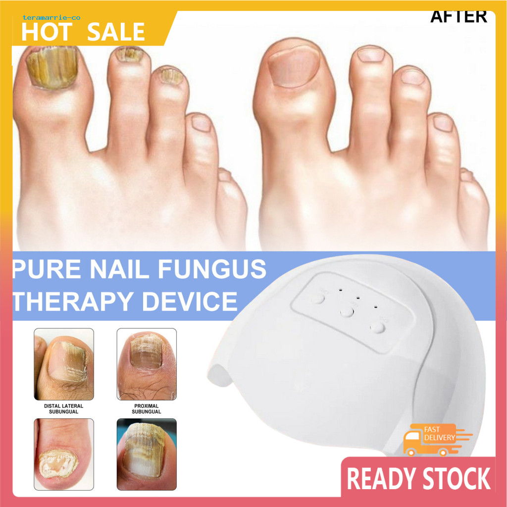 Blood Circulation Improvement Tool Infection Prevention Nail Device ...