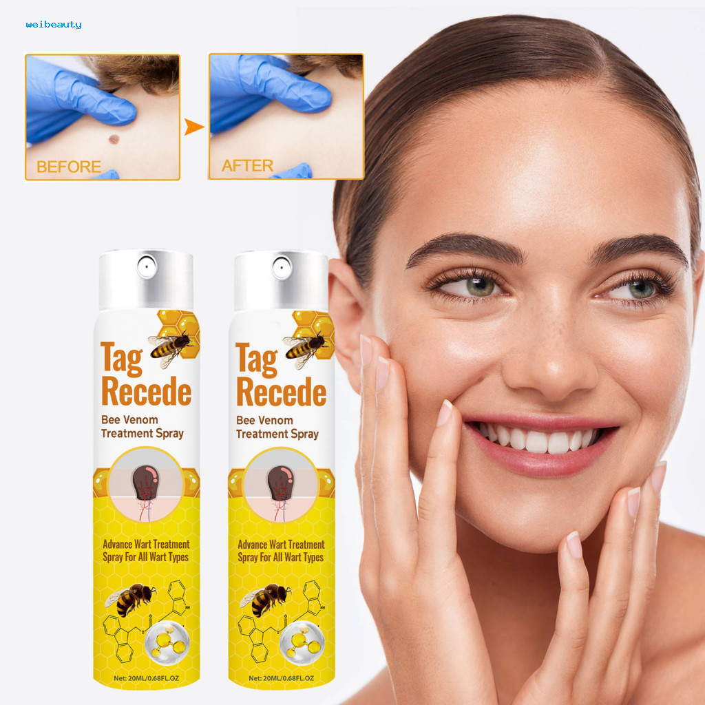 Natural Bee Venom Solution 20ml Tag Recede Spray Skin Removal Treatment ...