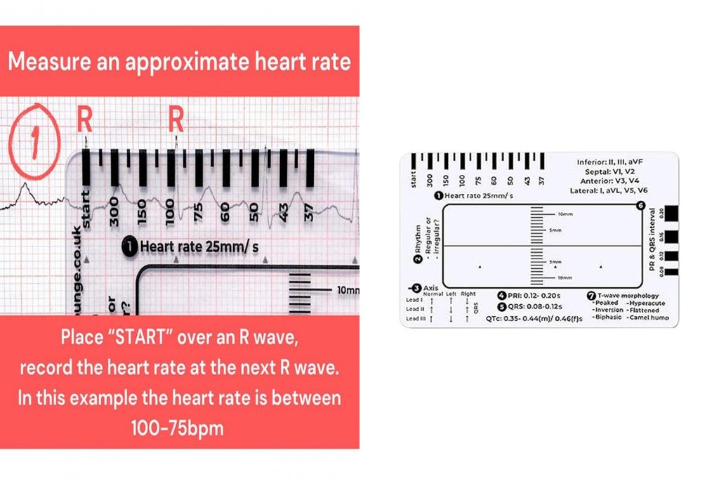 Electrocardiogram Measurement Tool Analysis Pocket Ekg Ruler Card for ...