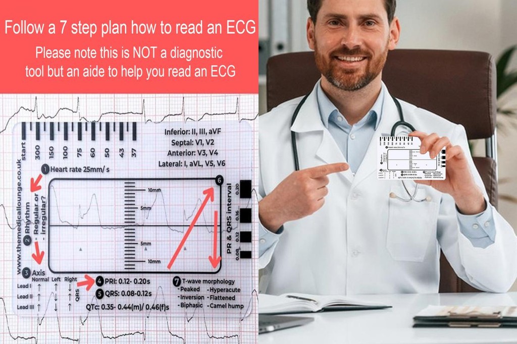 Ekg Reference Card Transparent Ruler Caliper Measuring Tool Set Easy ...