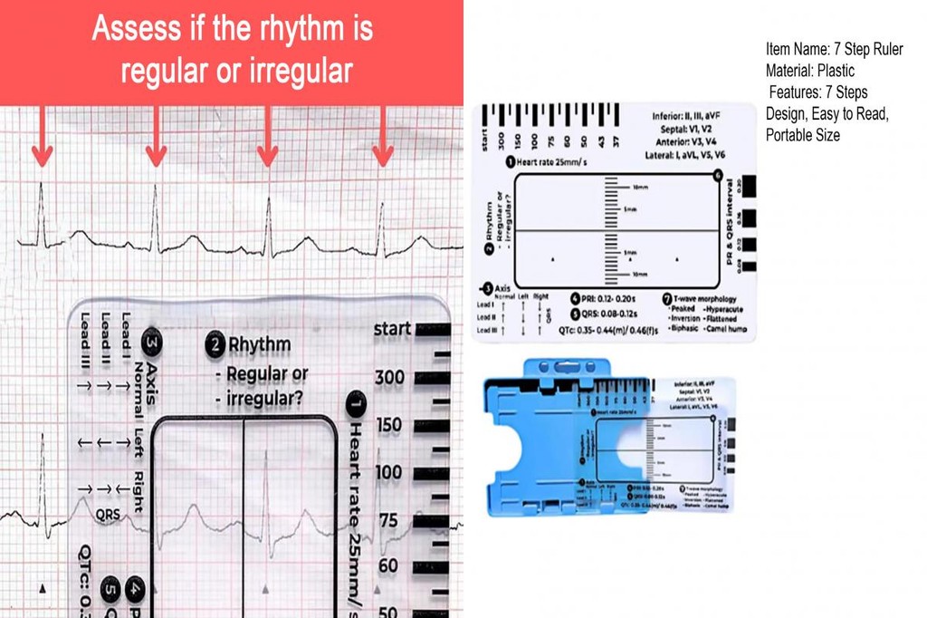 Ekg Measuring Tool Reference Card Transparent Caliper Set Easy Ecg ...