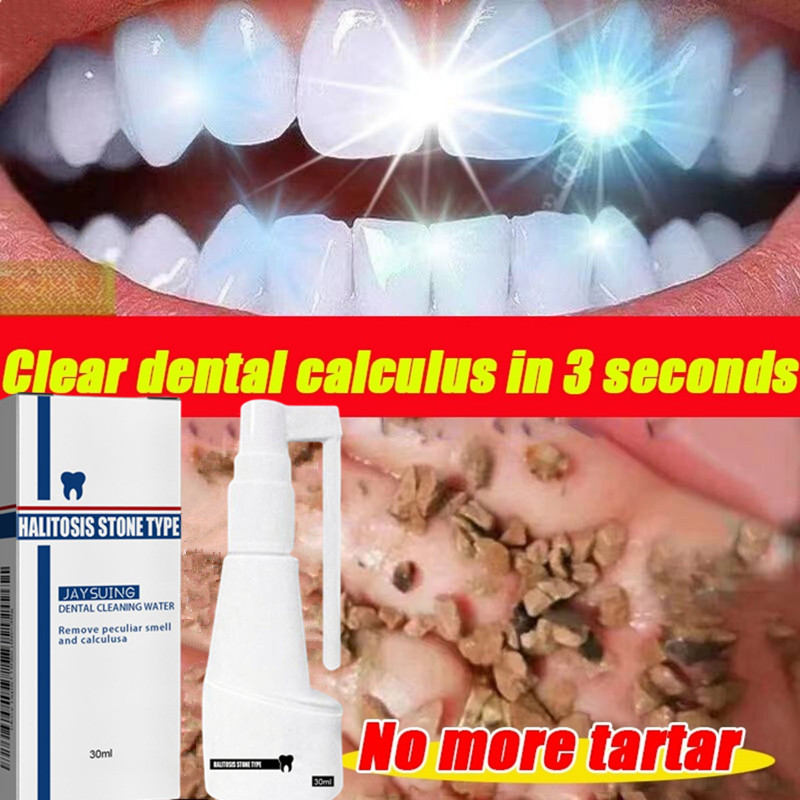 Eliminación De Placa Sarro Spray Karang gigi Removedor De Dientes ...
